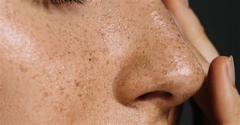 Fake Freckles Look More Realistic With This Tiktok Makeup Trick