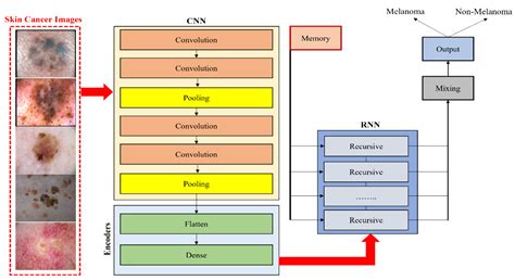 Methods For Melanoma And Nonmelanoma Skin Cancers Classification Encyclopedia Mdpi