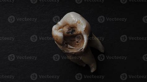 Macro Shot Of A Decayed Teeth Till Root After Extraction Of Dentist