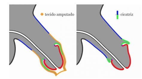 Postectomia Aumento De Pênis