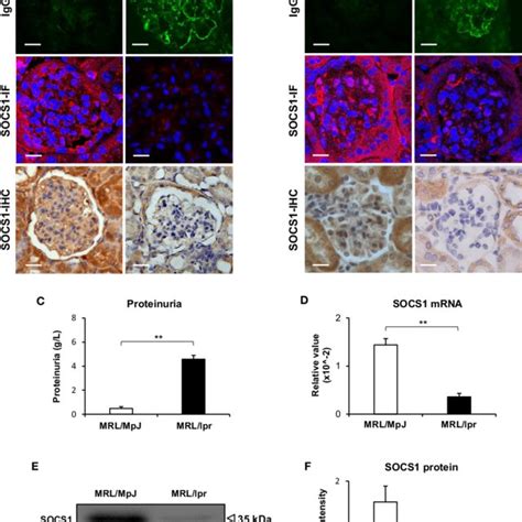 Evaluation Of Suppressor Of Cytokine Signaling 1 Socs1 And Janus