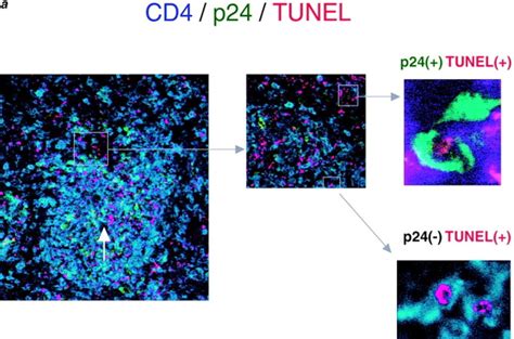 Apoptosis Occurs Predominantly In Hiv 1uninfected Cd4⁺ T Cells A