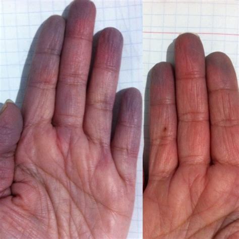 Blue Fingertips Death At Ruby Najar Blog