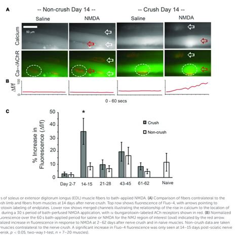 Recovery Of Toe Spread Reflex A Scoring Scheme For Quantification Of