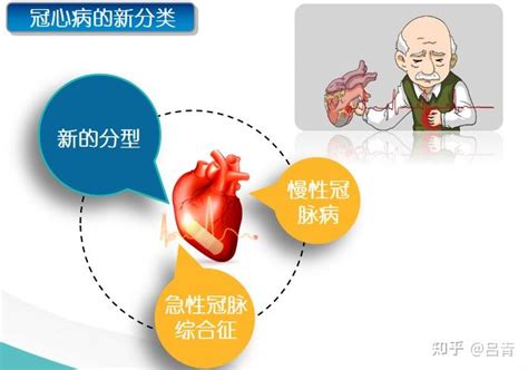 冠状动脉综合征，冠心病，acs，这三个是什么关系啊？ 知乎