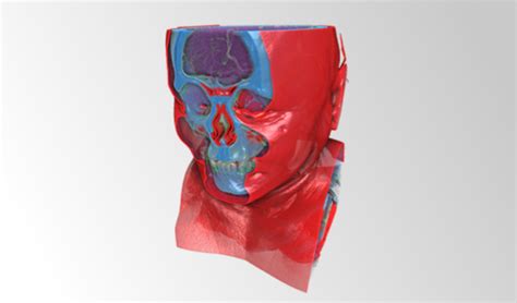 Medical Visualization Tu Wien Research Unit Of Computer Graphics