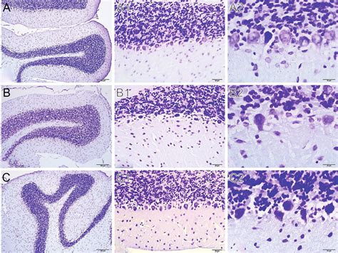 Cerebellum At 4× 40× 100× Magnifications In Crystal Violet Stain