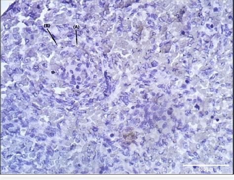 Photomicrograph 40× Showing Central Artery In Developing White Pulp