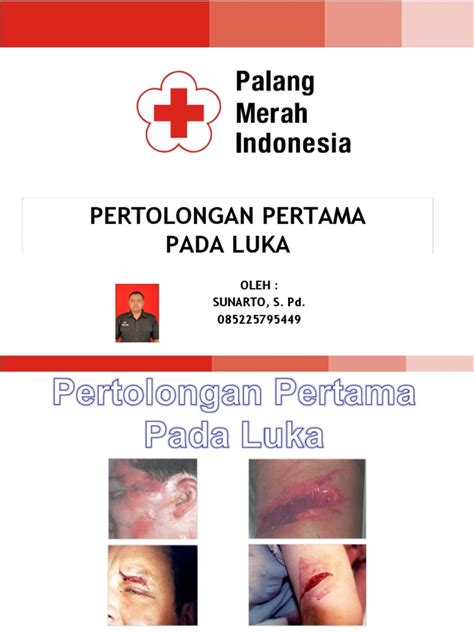 6 Cedera Jaringan Lunak Pdf