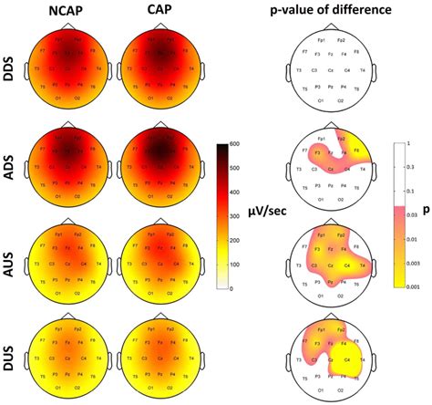 Cyclic Alternating Pattern Psychophysiology And Chronobiology