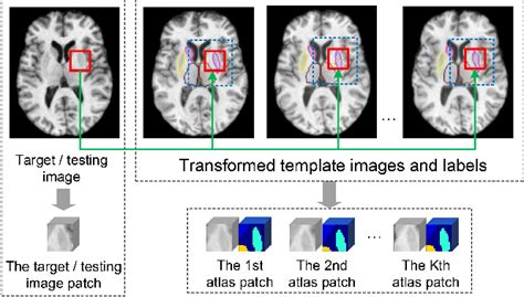 Figure 1 From A Multi Atlas Guided 3d Fully Convolutional Network For Mri Based Subcortical