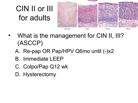 Cervical Cancer Screening Ppt