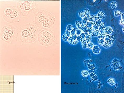Ppt Urinalysis Powerpoint Presentation Free Download Id2214675