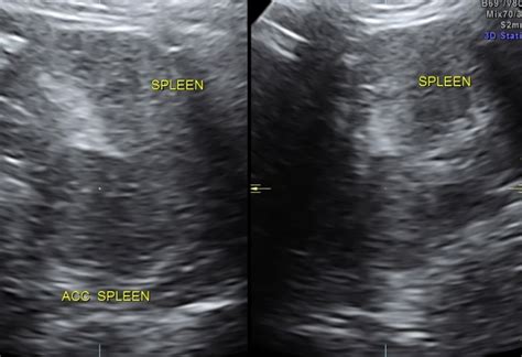 Splenunculus Looking Through A Transducer