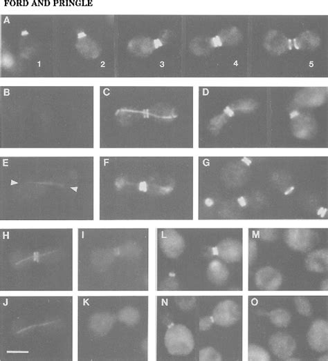 figure 1 from cellular morphogenesis in the saccharomyces cerevisiae cell cycle localization of
