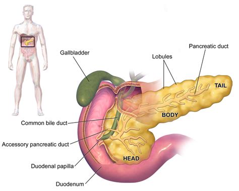 Metastatic Pancreatic Cancer Reprogrammed For Malignancy