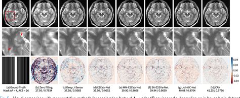 Figure 1 From Joint Cross Attention Network With Deep Modality Prior For Fast Mri Reconstruction