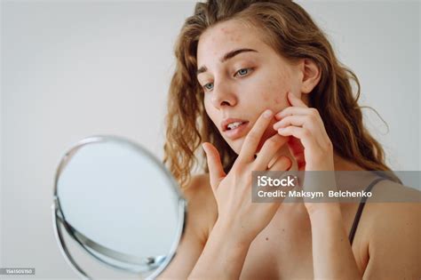 피부 트러블 곱슬 곱슬 한 여자는 밝은 방에서 거울을 보면서 얼굴에 붉은 염증을 만진다 20 24세에 대한 스톡 사진 및 기타