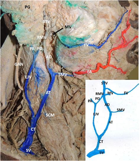 Cadaveric Specimen And Its Schematic Representation Showing The Facial