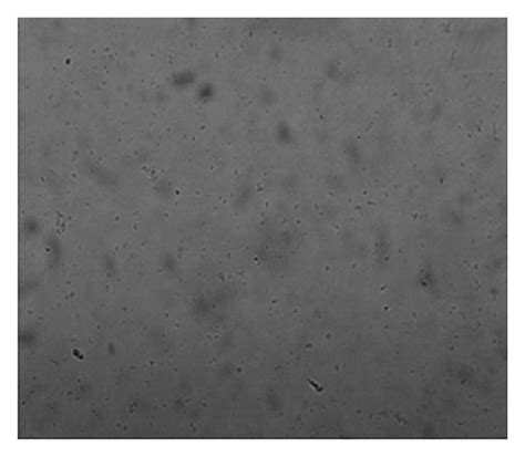 Morphology Of Apoptotic Bodies In Cells Treated With 0 5 Pm And 50 Nm