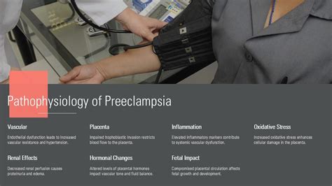 Preeclampsia And Polyhydramnios Ppt Mockup Acp Ppt Template