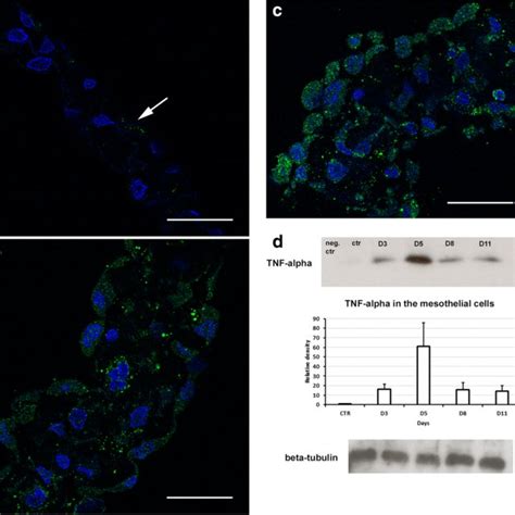 Egr1 Expression In Vivo Experiments A Control Mesothelial Cells Do
