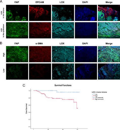 Lox Expressed In Tumor Stroma Is Colocalized With Cafs A Distribution
