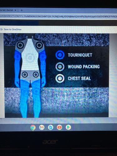 Trauma Flashcards Quizlet