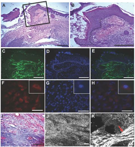 Histological Evaluation Of Chronic Wounds A Representative Picture