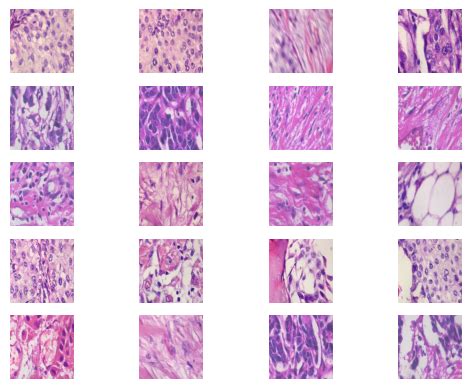 GitHub ChakradharMudili Breast Cancer Deep Learning Deep Learning