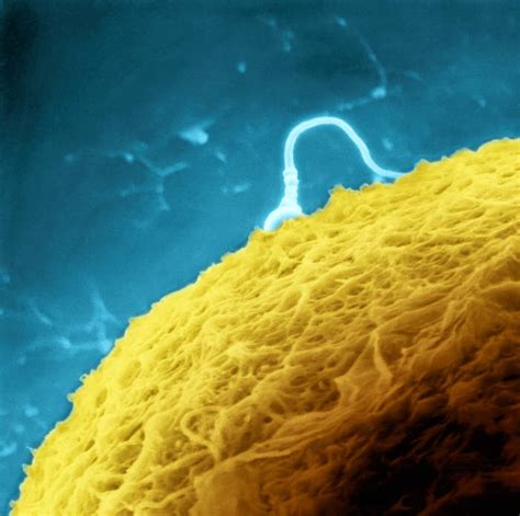 Ein Kind Entsteht Fotos Aus Dem Bauch Hebammenblog De