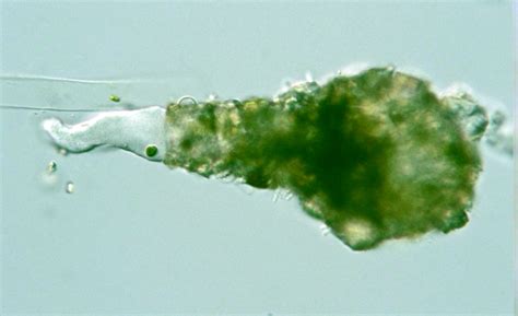 Protist Images Difflugia Oblonga
