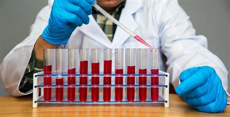 의료 장비 혈액 검사 혈액 샘플을 분석하는 실험실 조수 암 줄기 세포의 파이펫 연구를 가진 실험실에서 보조 여러 테스트 튜브 중 하나에 유체를 추가하는 피펫 피에 대한 스톡