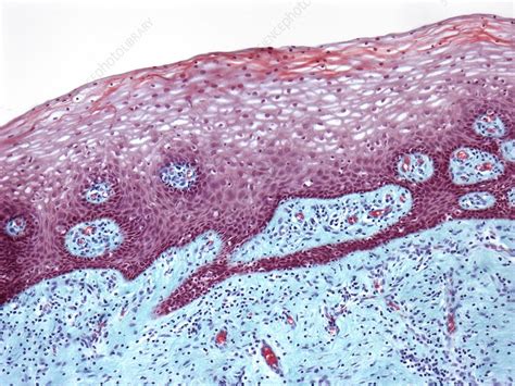 Human Cervix Light Micrograph Stock Image C023 8242 Science Photo Library