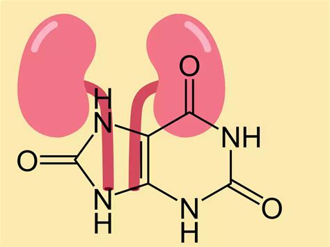 Understanding And Transforming Diet To Take Charge Of High Uric Acid