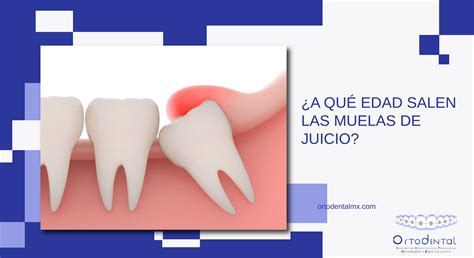 ¿a Qué Edad Salen Las Muelas De Juicio Ortodental
