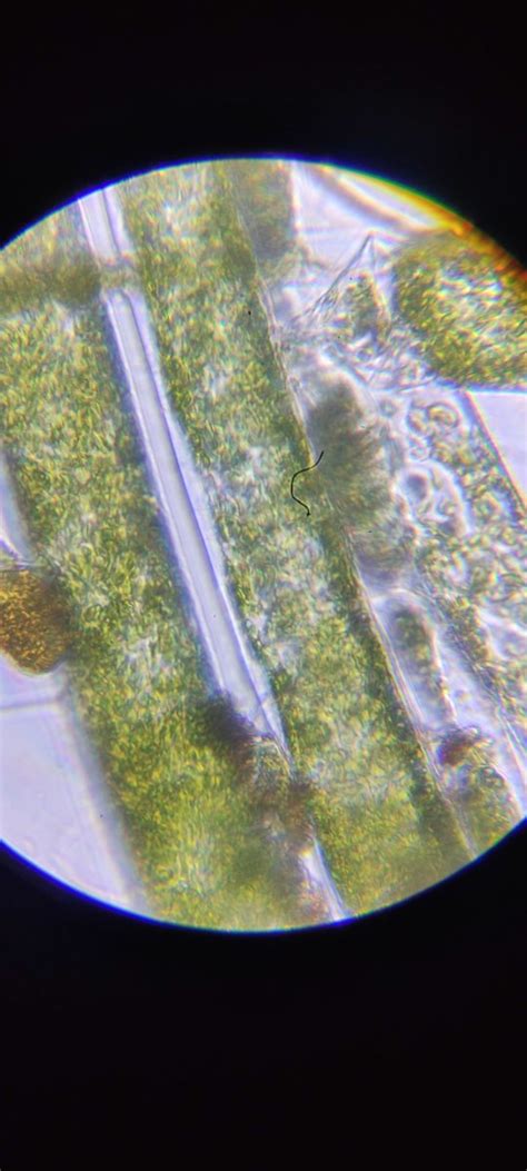 Microscopic Images Algaebug Id Reef2reef Saltwater And Reef