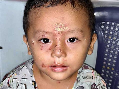 מחלות עור ספוט קליניק מבצעת אבחון וטיפול בכל סוגי מחלות העור