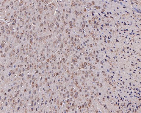 Slc25a37 Polyclonal Antibody Pa5 119913