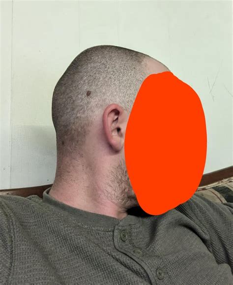 Dont Really Like My Head Shape Am I Too Harsh On Myself Or Is It