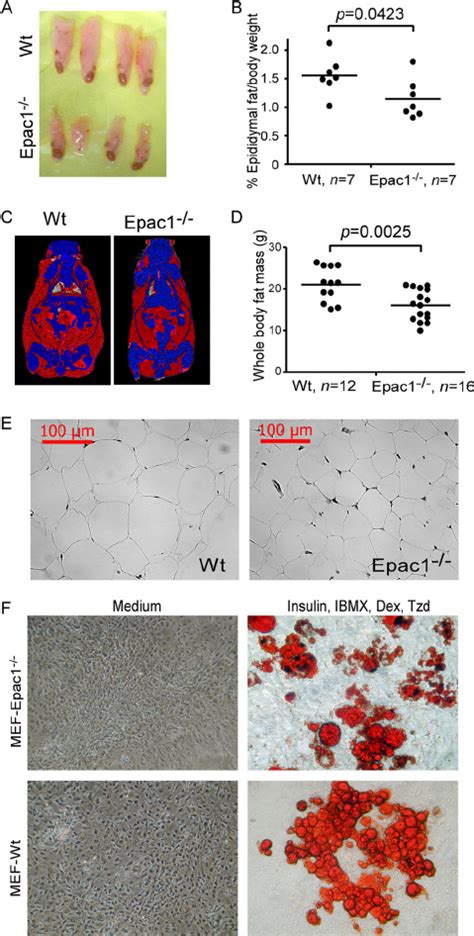 Epac1 Deficiency Reduces Plasma Leptin Levels Fasting Plasma Leptin Download Scientific