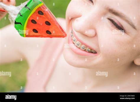 Beautiful Young Woman With Braces On Her Teeth Eats A Watermelon Shaped Lollipop Outdoors Stock