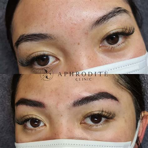 Wat Zijn Powder Brows Aphrodite Clinic
