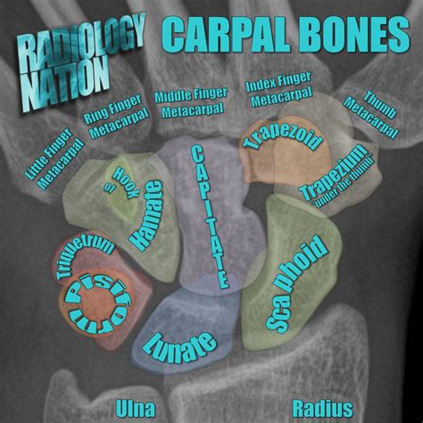 Musculoskeletal Radiographs — Radiology Nation