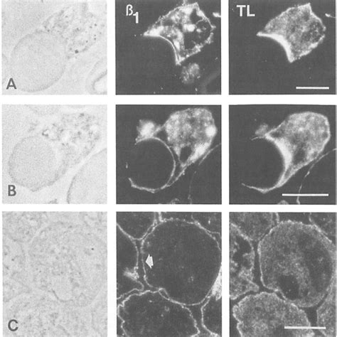 Aggregation Of Integrin Fij And Talin Tl At Initial Sites Of Cell
