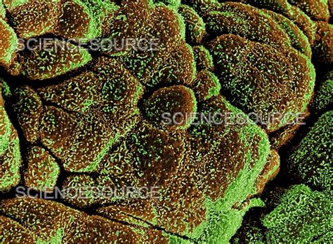 Bladder Epithelium Stock Image Science Source Images