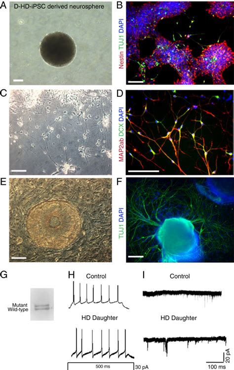 Differentiation Of D Hd Ipscs Into Neural Progenitors Immature And Download Scientific Diagram