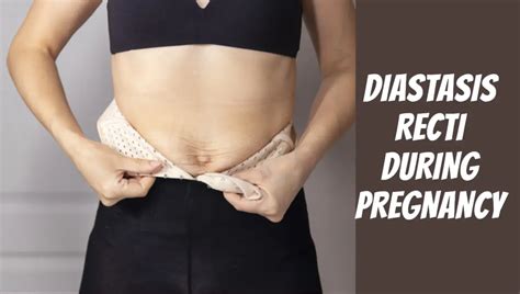 Diastasis Recti During Pregnancy Prevention Treatment And Exercises