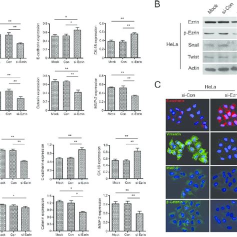 Ezrin Regulates Emt In Cervical Cancer A Western Blot Analysis Of