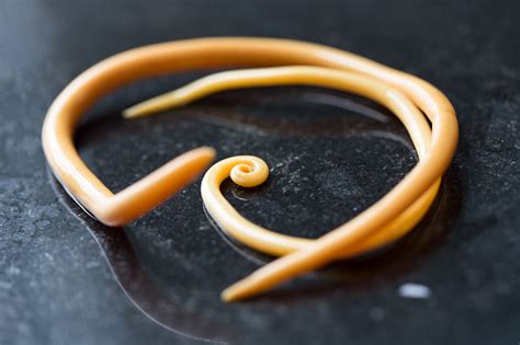 Ascariasis Adalah Penyakit Yang Disebabkan Oleh Cacing Gelang Parasit Ascaris Lumbricoides Untuk